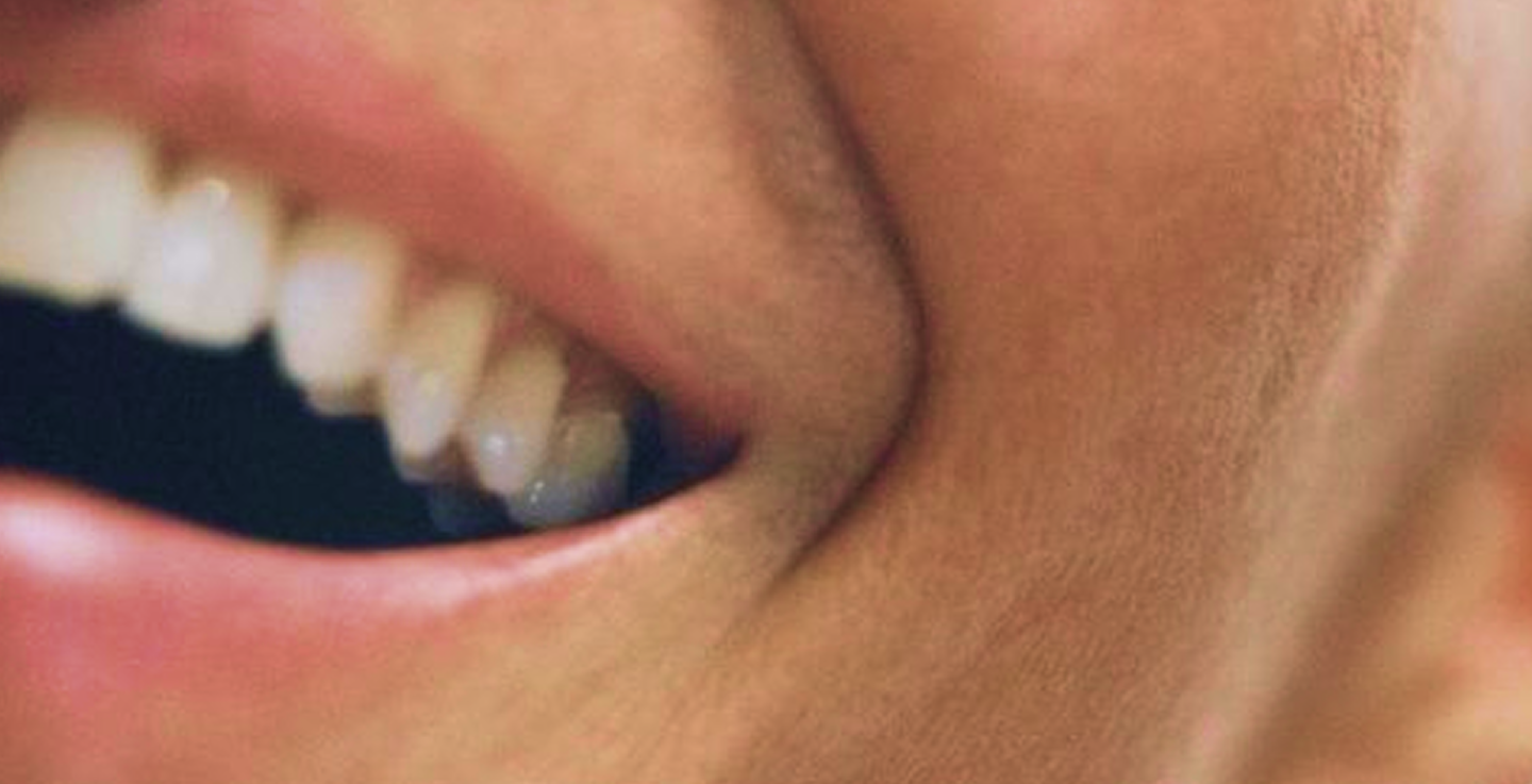 Book Your Smile Assessment - Smile Refresh